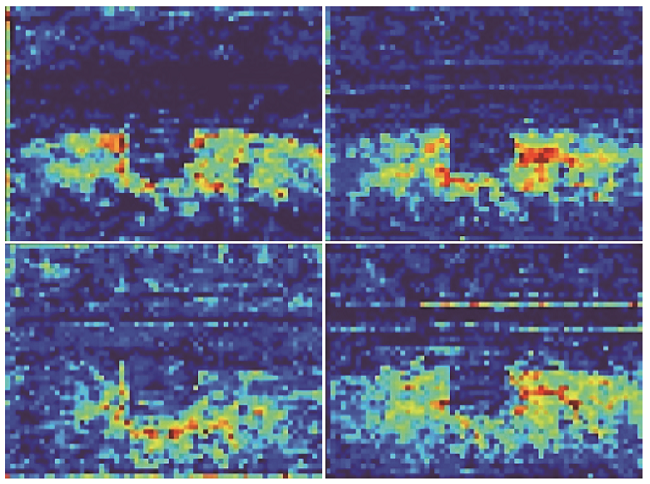 Improved Dense Crowd Counting Method based on Residual Neural Network